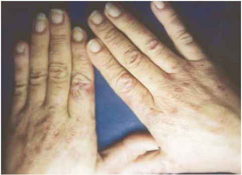 Absorción dérmica – SatirNet Safety